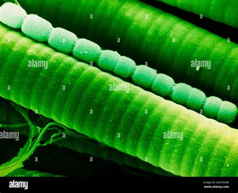 False Colour Scanning Electron Micrograph Sem Of Two Species Of Blue Green Algae Microcoleus