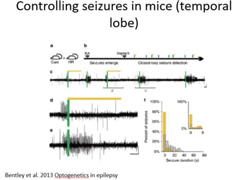 Fixing Faulty Neural Circuitry Neural Circuits Flashcards Quizlet