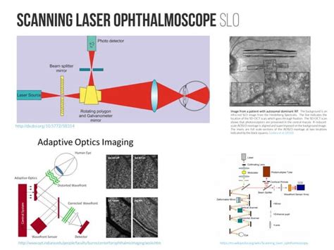 Shallow Introduction For Deep Learning Retinal Image Analysis Pdf Eye And Vision Conditions