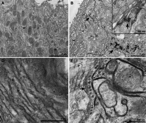 Route Of Zika Virus Infection In Aedes Aegypti By Transmission Electron