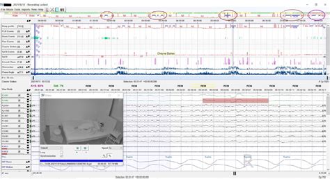 Figure From EEG Based Artistic Visualization Of Dreams Semantic Scholar