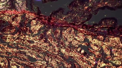 Contrast Microscopic Slide With Cervix Tissue Sample Magnified In 40 Times Filmed With Cross