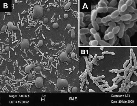 Scanning Electron Microscope Sem Of A Control No Treatment And