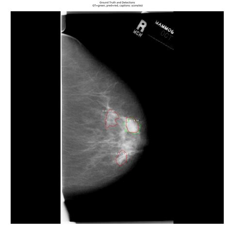 Mask Iou Larger Than One · Issue 535 · Matterport Mask Rcnn · Github