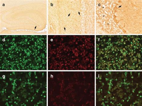 3 Staining Pattern Of Aqp4 Antibodies On A Tissue Based Assay Optimized