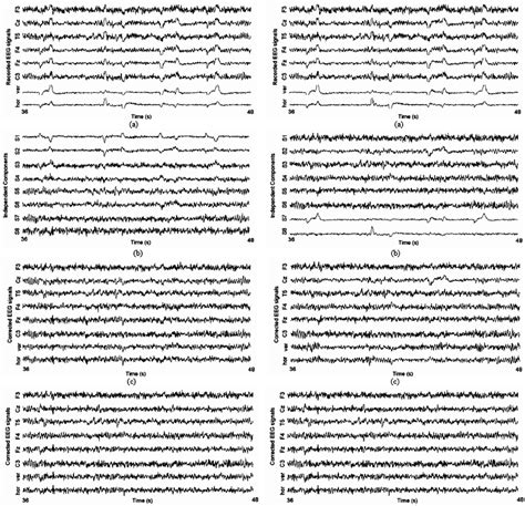 A Portion Of Measured Eeg Signals B Extracted Independent Download High Resolution