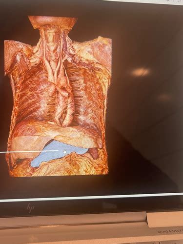 A P Lab 2 Practicum Flashcards Quizlet