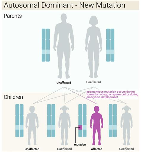 Treacher Collins Syndrome Causes Signs Symptoms Diagnosis And Treatment