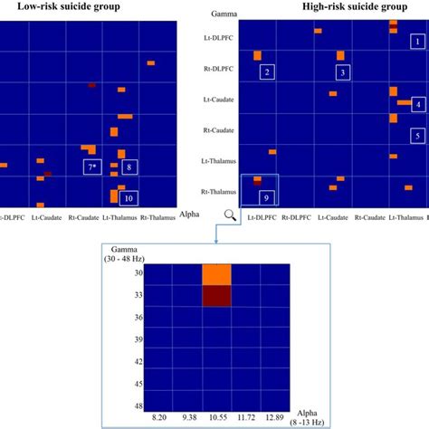 The Cortico Striato Thalamo Cortical Cstc Circuit Download