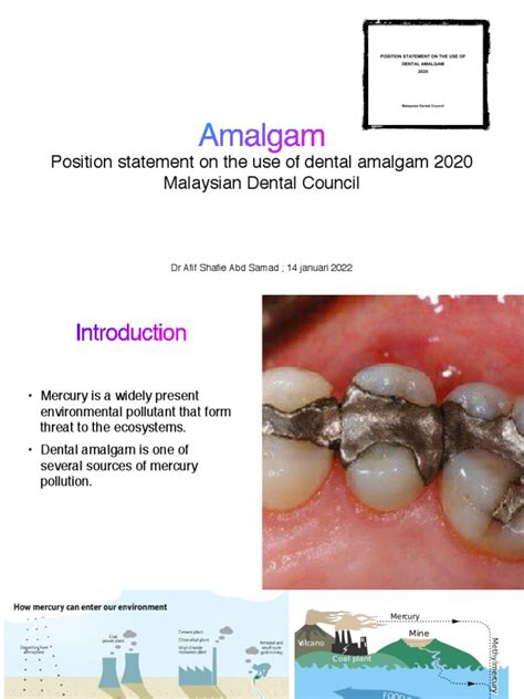 Amalgam Cde 14 01 22 Pdf