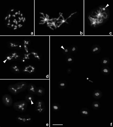 Dapi Banding In S Batatas A Spermatogonial Mitosis Chromosomes