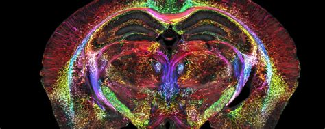 Sharpest Images Ever Captured Of A Mouse Brain