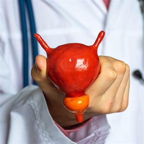 Prostatectomía Radical En Cdmx