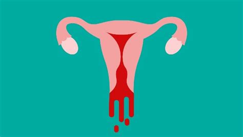 Vaginal Bleeding After Sex Know The Causes Of Postcoital Bleeding