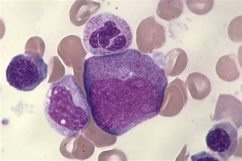 Leukocyte Pictures Flashcards Quizlet