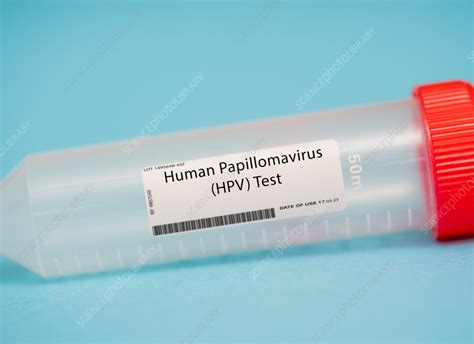 Human Papillomavirus Test Stock Image F0420129 Science Photo Library