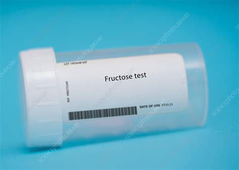 Fructose Test Stock Image F0420102 Science Photo Library