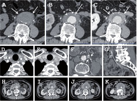 Radiographic Findings A C Seventy Three Year Old Man With