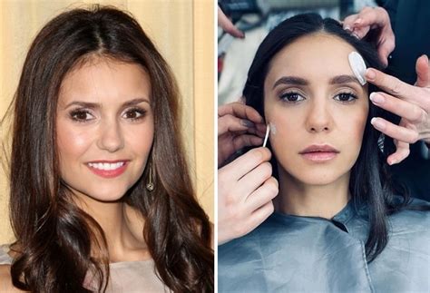 Nina Dobrev Before And After Plastic Surgery Face Nose Boob