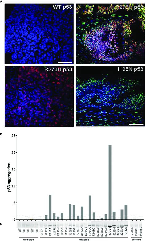 Detection Of P53 Aggregates In Ovarian Cancer Oc Tissue Specimens