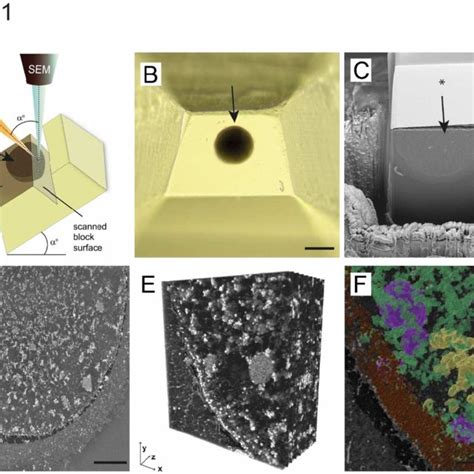 Pdf High Resolution 3d Reconstruction Of Human Oocytes Using Fib Sem