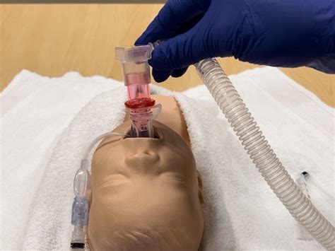 Nicu Implements Latest Neonatal Resuscitation Guidelines Kaiser