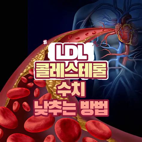 Ldl 콜레스테롤 수치 및 낮추는 방법