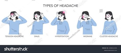 Cluster Headache Illustration