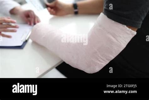 Ray Distal Forearm Fracture Stock Videos And Footage Hd And 4k Video Clips Alamy