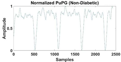 Non Diabetic Signal After Normalization Download Scientific Diagram