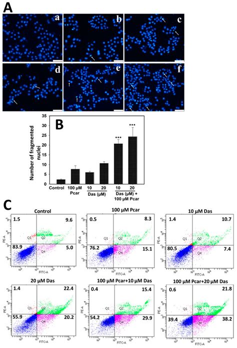 Synergistic Anti Tumor Effect Of Palmitoylcarnitine And Dasatinib In Liver Cancer