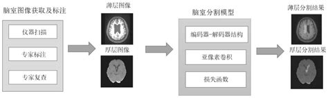 一种基于改进u net的患者脑室图像分割方法
