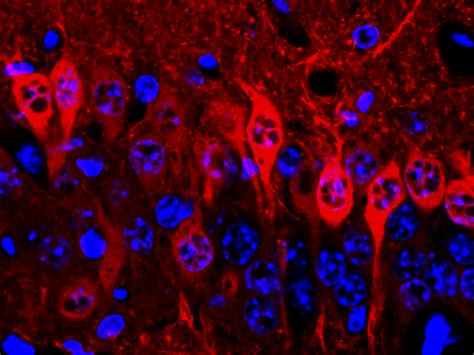 Computational Biology Genetics