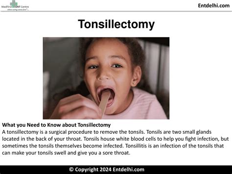 Ppt Tonsillectomy Surgery Cost In Delhi Powerpoint Presentation Free