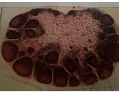 Lymph Node Microscope Quiz