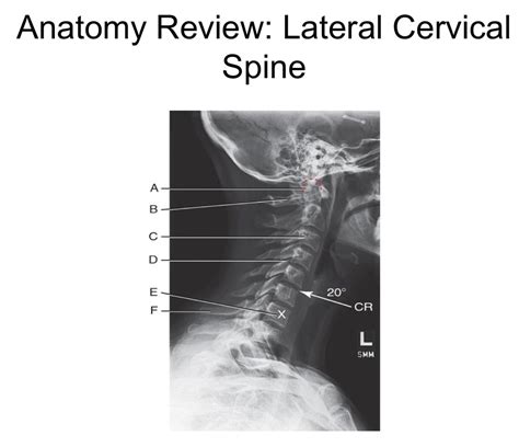 Lateral C Spine Diagram Quizlet