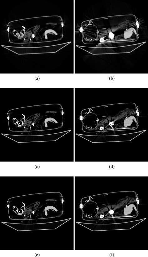 Figure 6 From A Model Based 3d Multi Slice Helical Ct Reconstruction Algorithm For