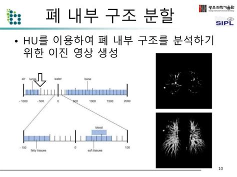 폐 Ct영상에서 Voxel Classification을 이용한 폐 결절 검출