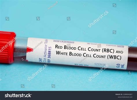 Wbc Test Images Stock Photos Vectors Shutterstock