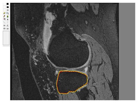 GitHub Terselich Deep Learning For Medical Image Segmentation Trained Machine Learning Model