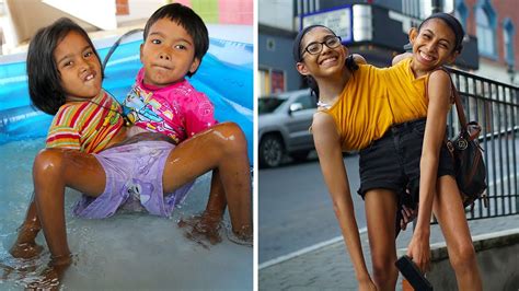 САМЫЕ НЕОБЫЧНЫЕ И СТРАННЫЕ ЛЮДИ В МИРЕ Топ 5 Самых необычных БЛИЗНЕЦОВ на планете Youtube