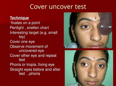 Clinical Evaluation Of Strabismus Patientspptx