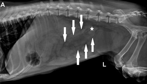 Intussusception X Ray