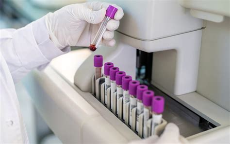 Using Iqcp To Improve Clia Compliance And Lab Testing System Quality