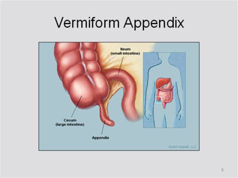 Vermiform Appendix