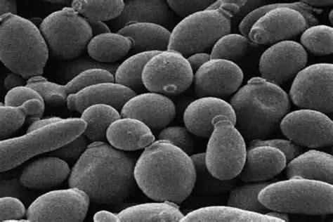 Yeast Fermentation Innovations And Techniques Ritai Bioreactor