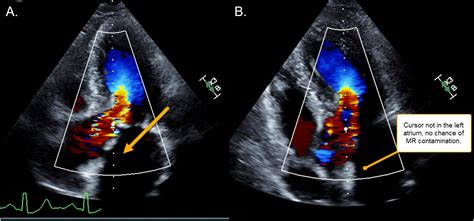 A Practical Approach To Echocardiographic Imaging In Patients With