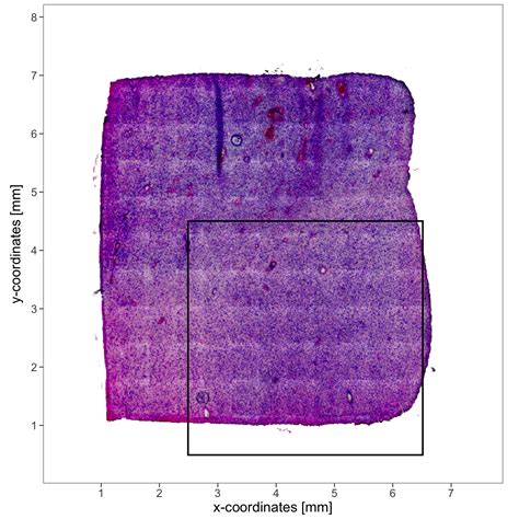 Spatial Measures • Spata2
