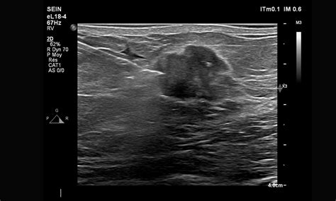 Imagerie De La Femme Imadians