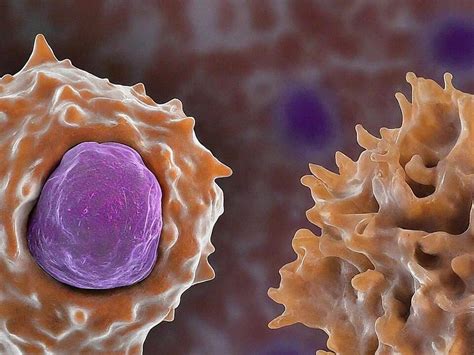 Isa Vrd Significantly Improves Survival Vs Vrd In Transplant Eligible Myeloma